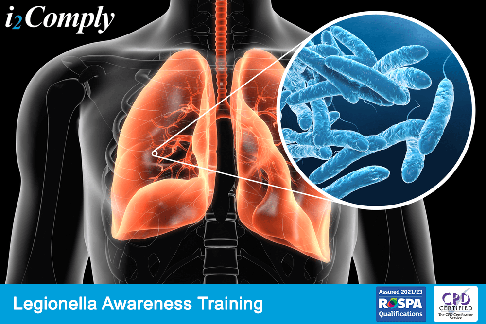 What is Legionnaires' disease? | i2Comply